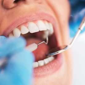 Dr Romane THUILLIEZ, Chirurgien-dentiste à Porto-Vecchio - Doctolib