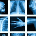 Radiographie du sternum Caen 14000 : Prenez rendez-vous en ligne | Doctolib