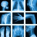 Radiographie du gril costal Châteaubriant 44110 : Prenez rendez-vous en ...