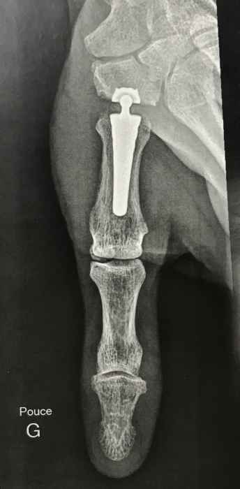 Dr Nicolas Gibert, Chirurgien orthopédiste et traumatologue à Arnas ...