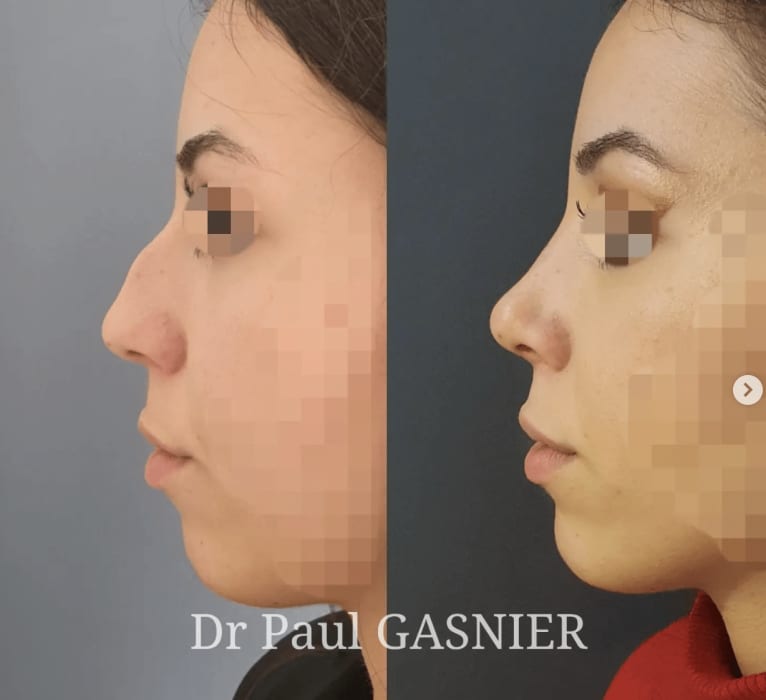 Dr Paul GASNIER, Spécialiste en chirurgie plastique reconstructrice et ...