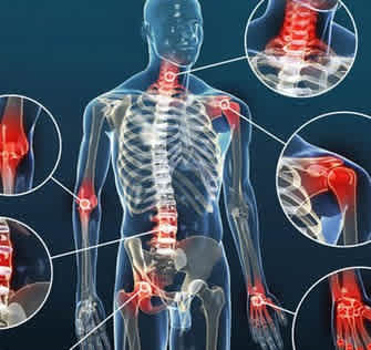 Dr Julien Mélet, Rhumatologue à Tours, Chambray-lès-Tours - Doctolib