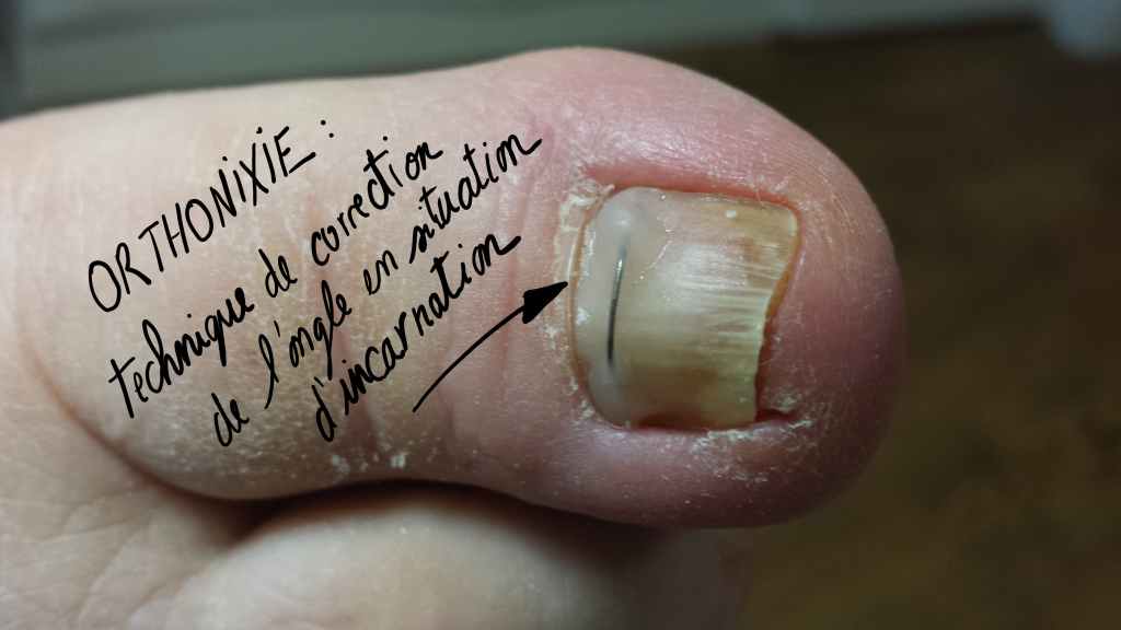 Thomas Fenech, Pédicure-podologue à Alençon : Prenez RDV en ligne ...